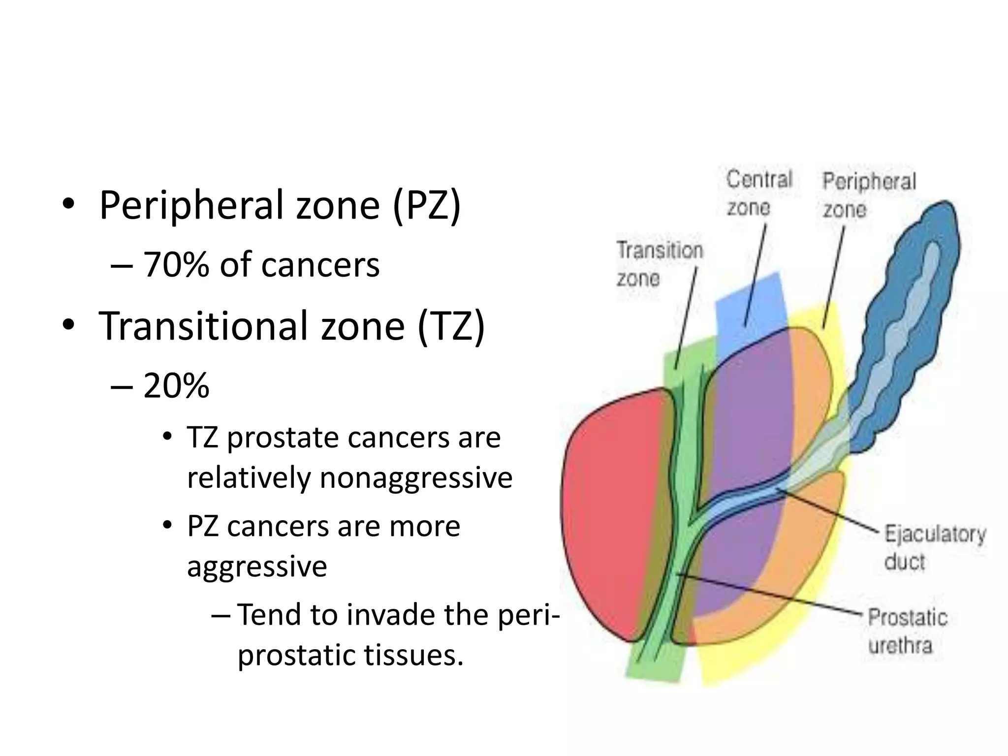 CA Prostate | PPTX | Cancer | Diseases and Conditions