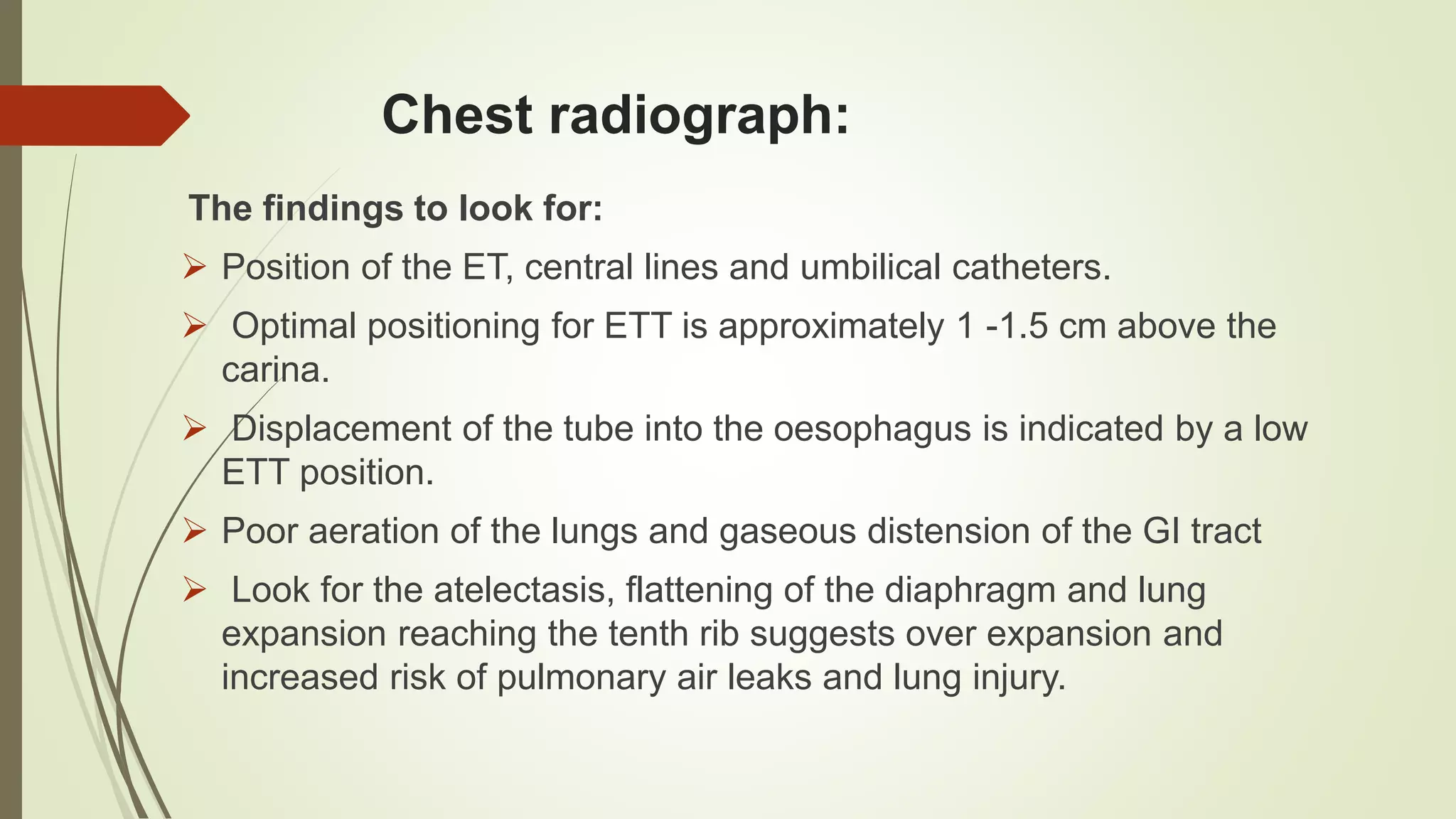 care of child on ventilator | PPTX