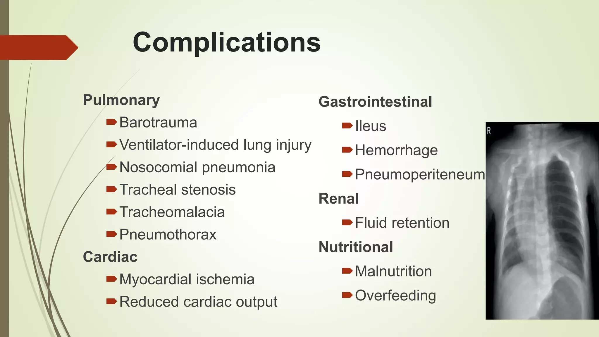 care of child on ventilator | PPTX
