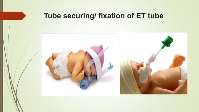 care of child on ventilator | PPTX | Lung and Respiratory Health ...