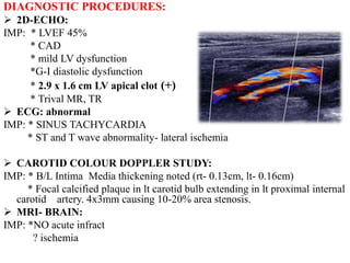 Cerebro-Vascular Accident (CVA) | PPT