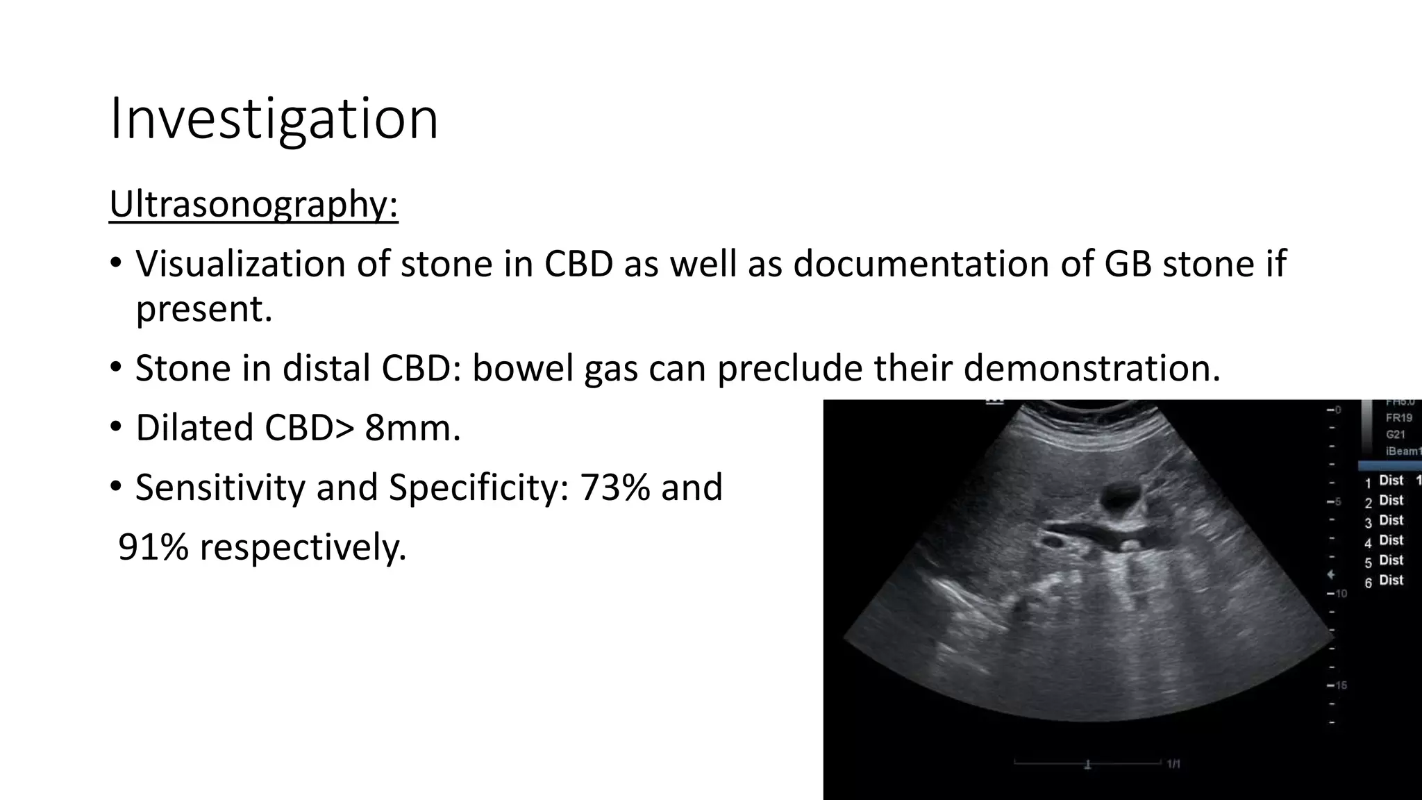 Choledocholithiasis- Management | PPTX