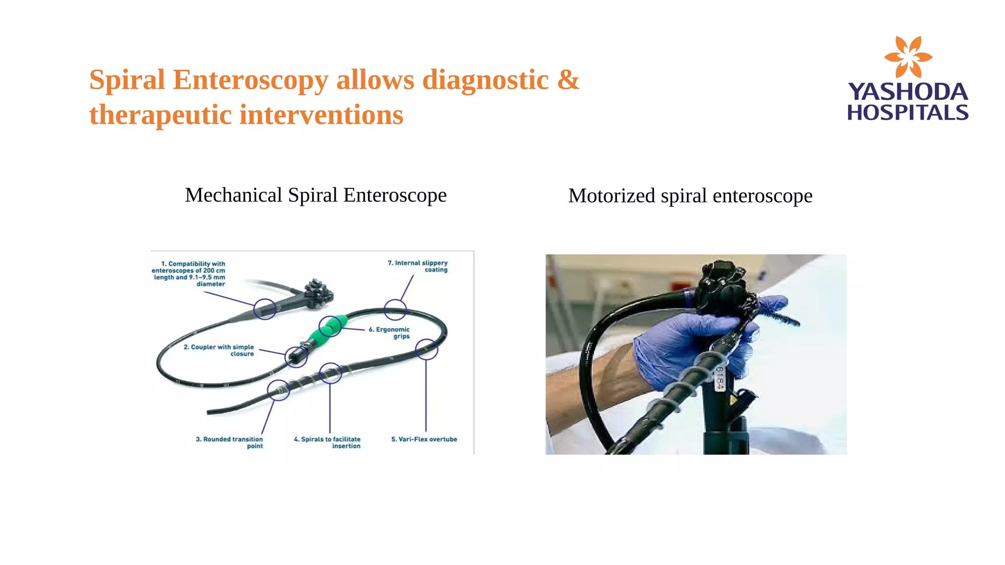 Capsule Endoscopy & Motorized Spiral Enteroscopy for Small Bowel ...