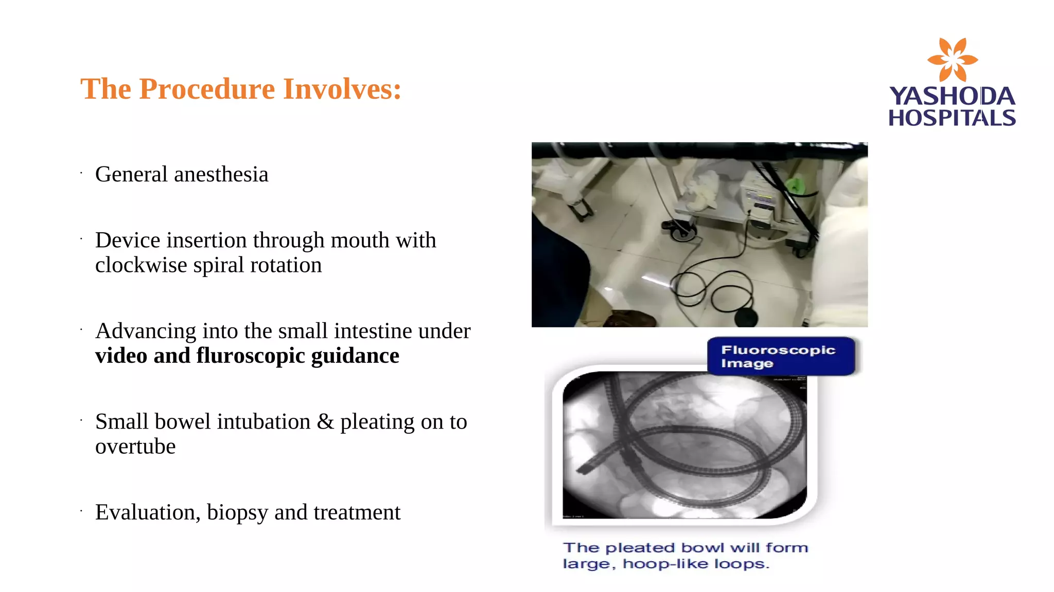 Capsule Endoscopy & Motorized Spiral Enteroscopy for Small Bowel ...