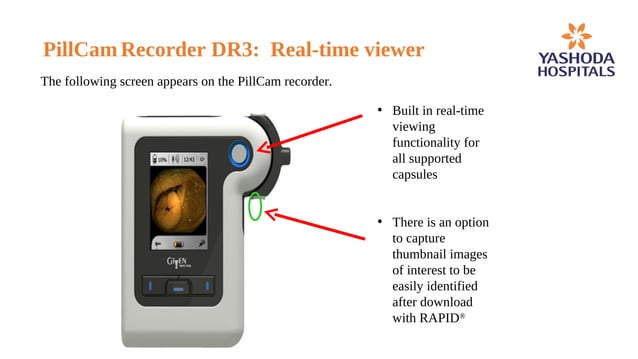 Capsule Endoscopy & Motorized Spiral Enteroscopy for Small Bowel ...