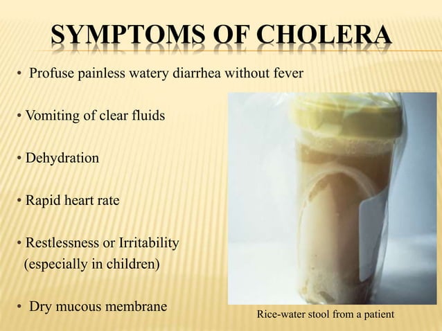 final cholera presentation.pptx | Infectious Diseases | Diseases and Conditions