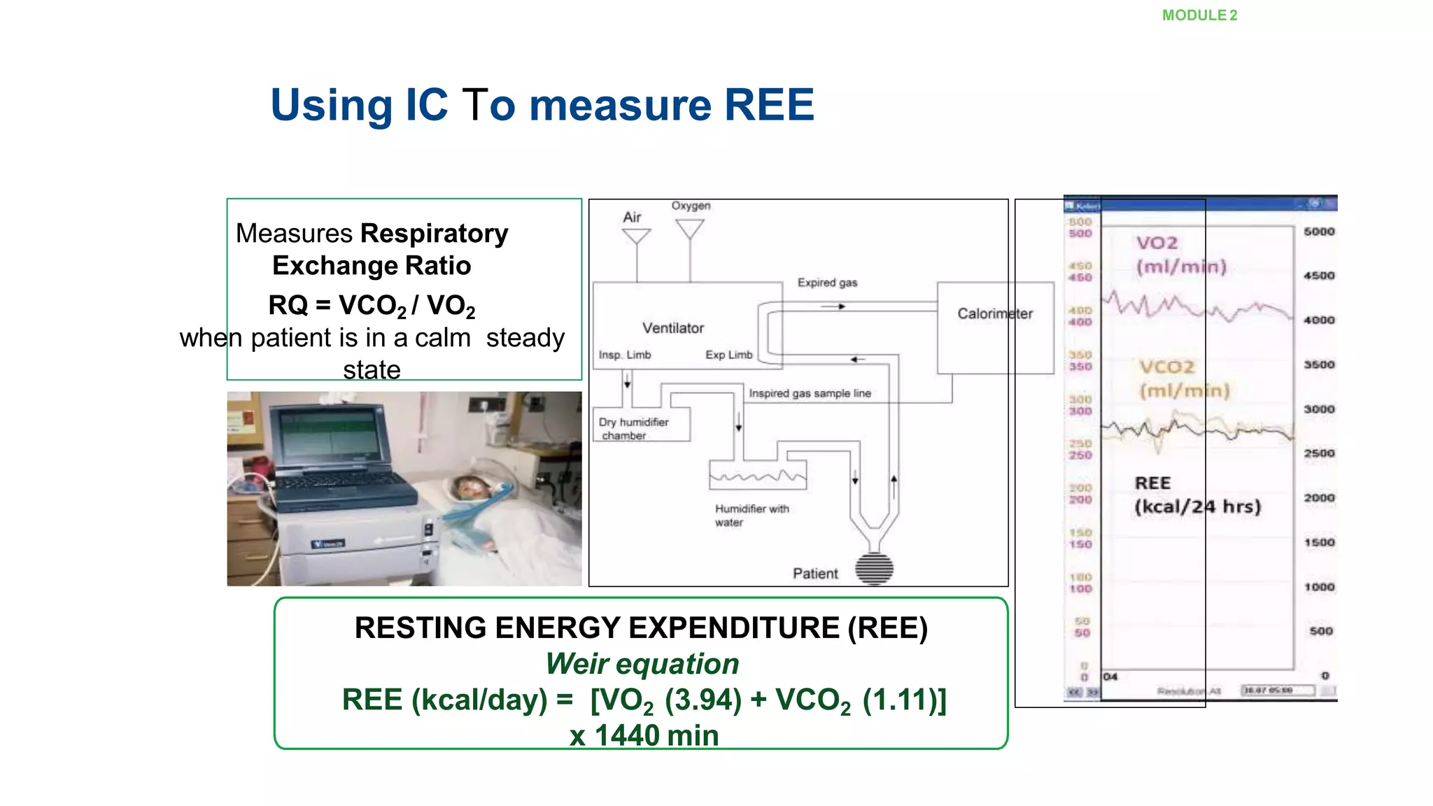 nutritional need of critical ill child | PPTX