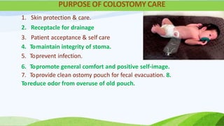 stoma and colostomy care and nursing management | PPTX