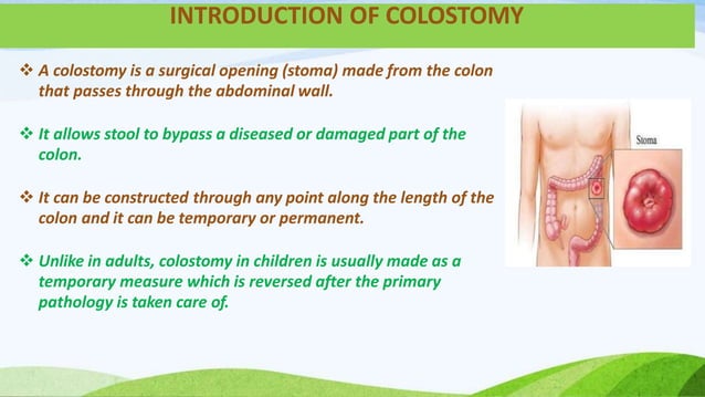 stoma and colostomy care and nursing management | PPTX