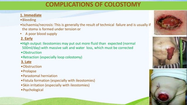 stoma and colostomy care and nursing management | PPTX