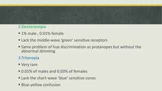 Color vision : Physiology ,Defects, Detection, Diagnosis & Management ...