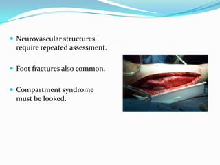 Compound Fracture Tibia | PPTX
