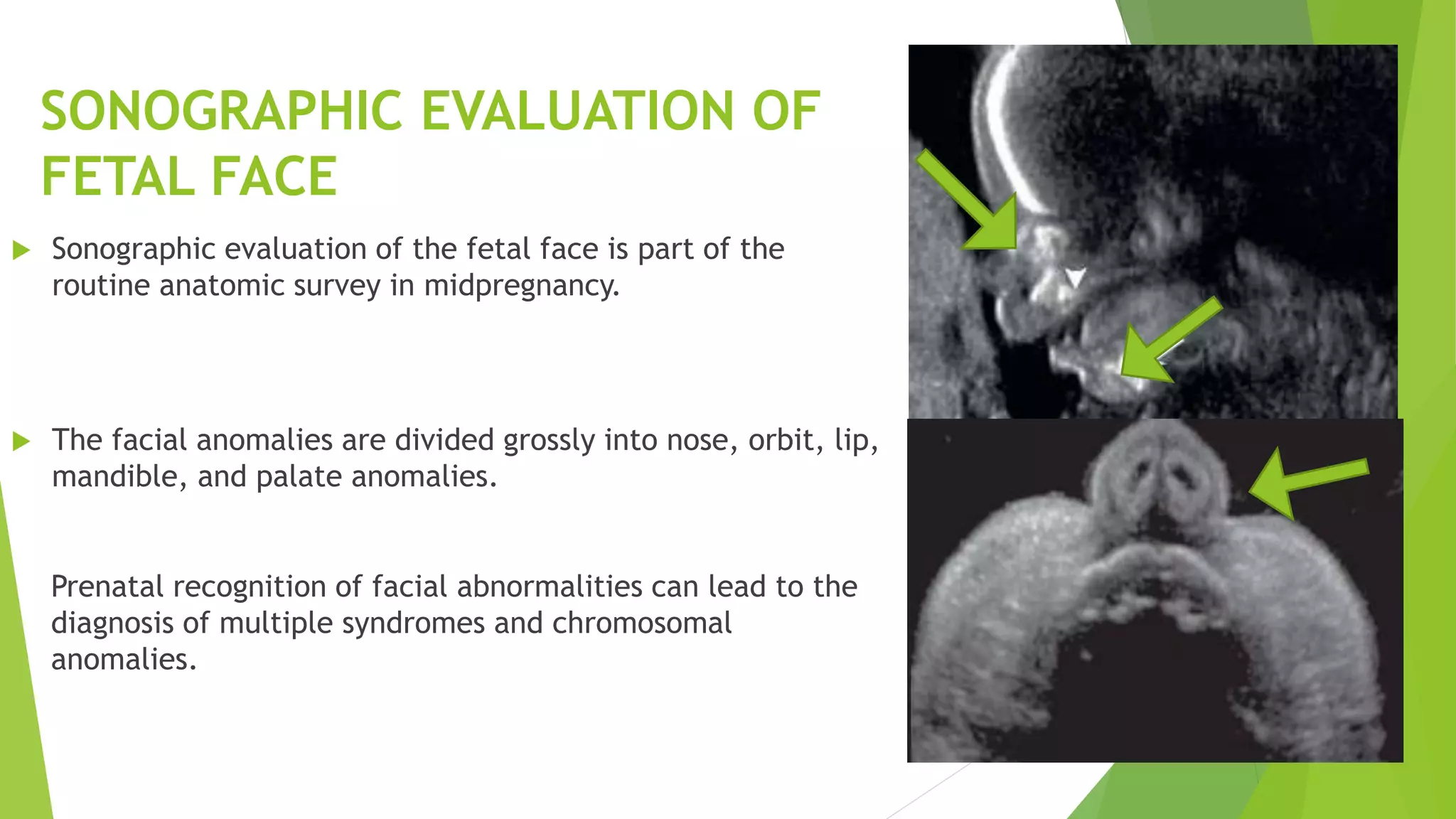 Congenital anomalies of head,neck and face(Radiology) including USG and ...