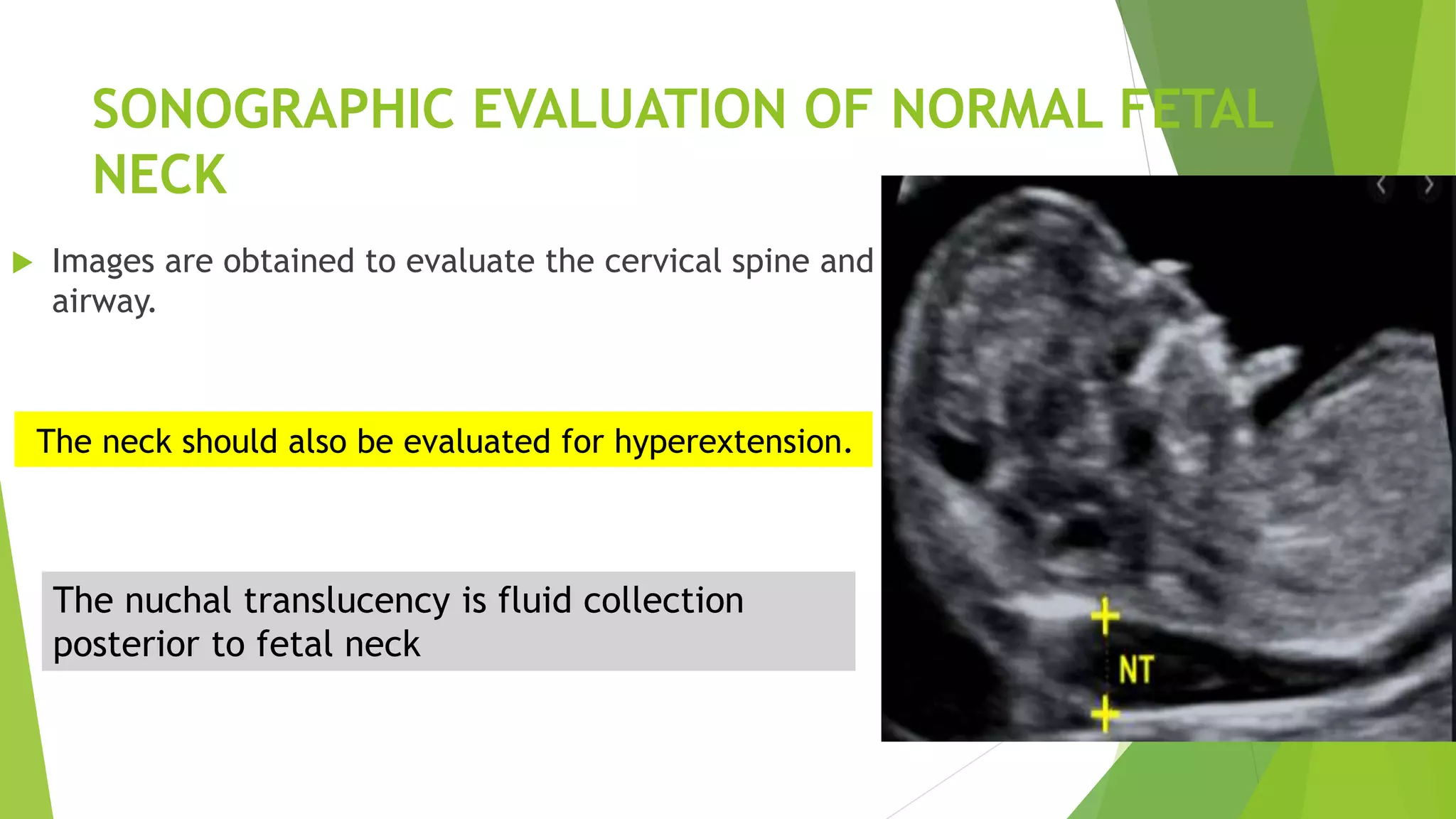 Congenital anomalies of head,neck and face(Radiology) including USG and ...