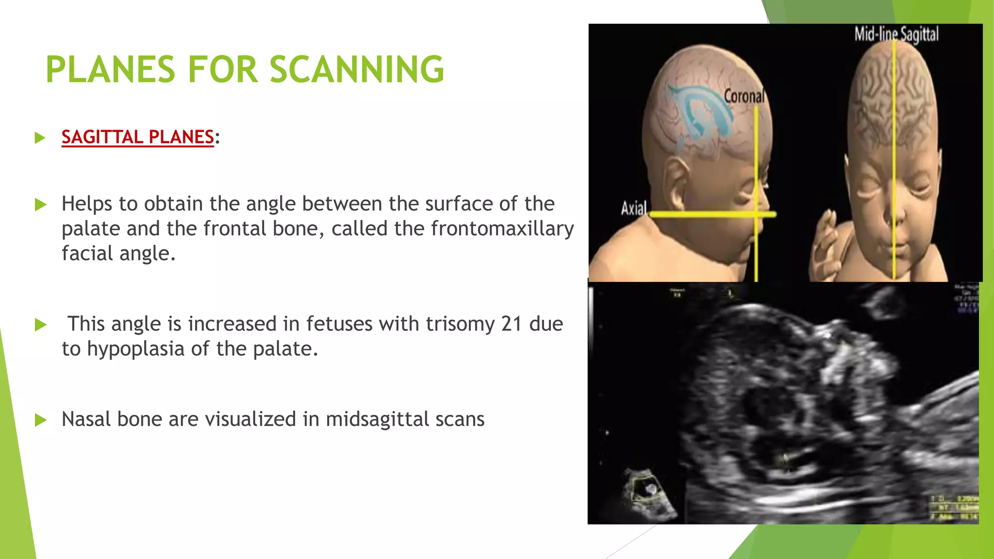 Congenital anomalies of head,neck and face(Radiology) including USG and ...