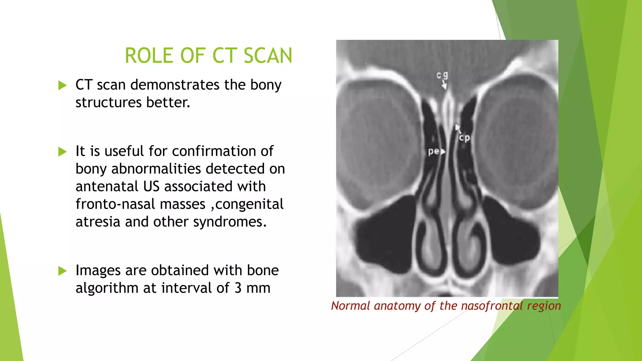 Congenital anomalies of head,neck and face(Radiology) including USG and ...