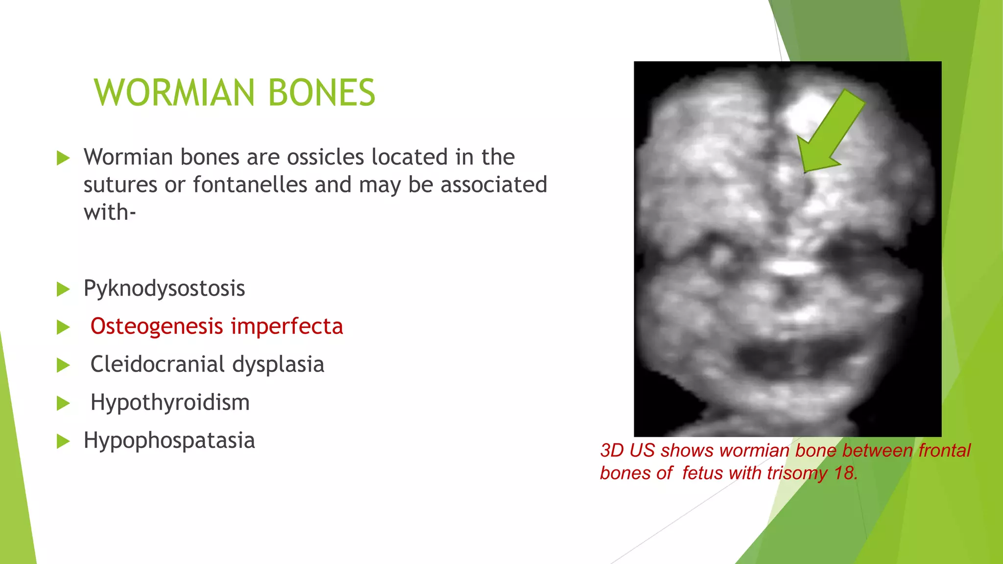 Congenital anomalies of head,neck and face(Radiology) including USG and ...