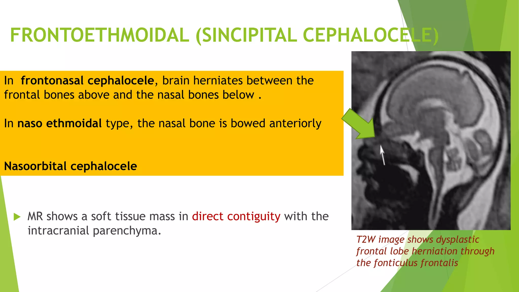 Congenital anomalies of head,neck and face(Radiology) including USG and ...