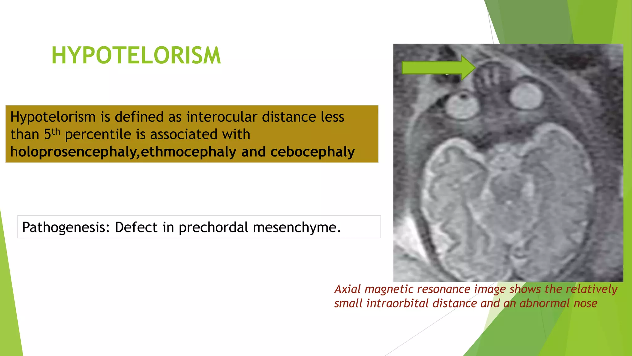 Congenital anomalies of head,neck and face(Radiology) including USG and ...