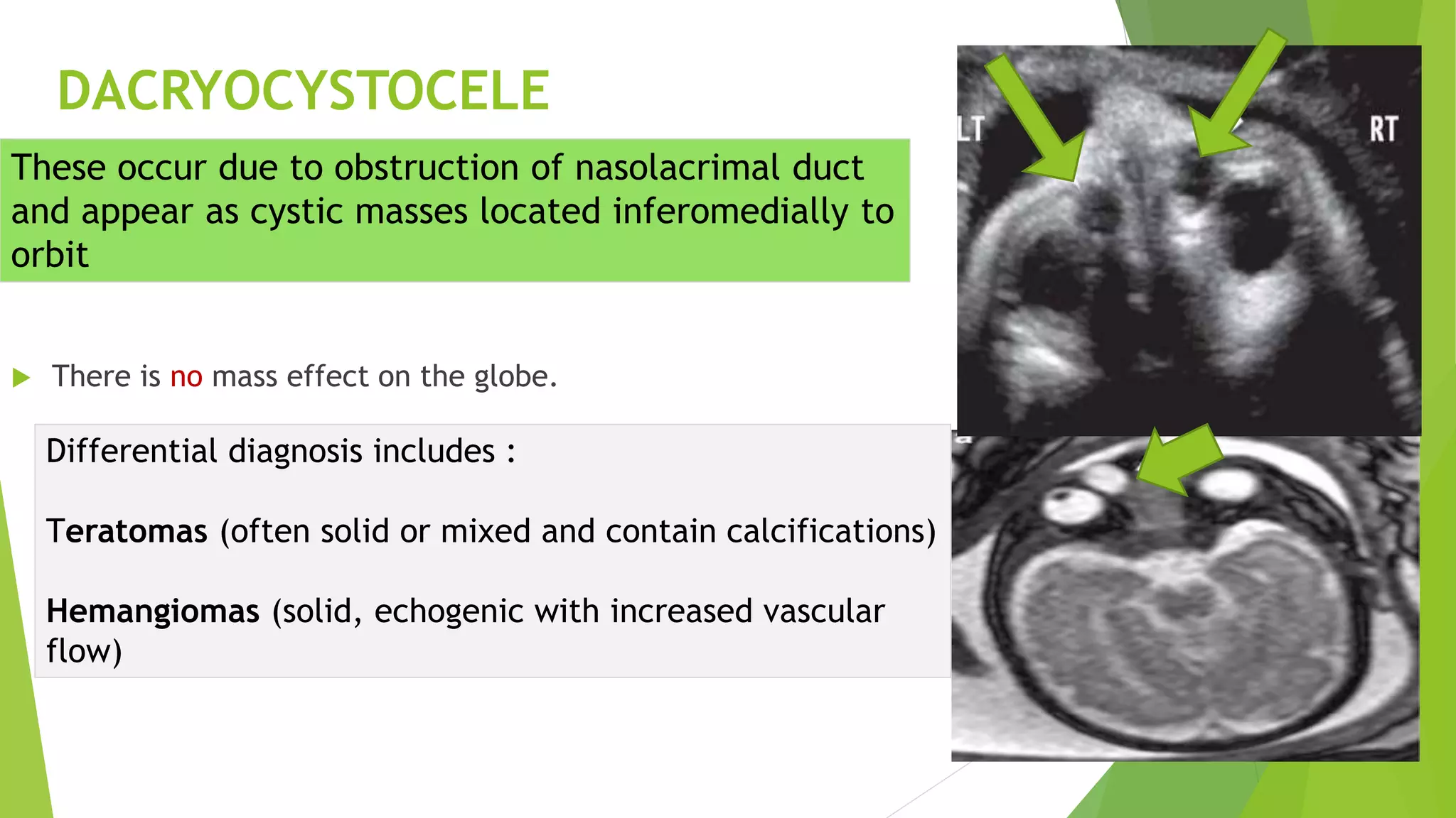 Congenital anomalies of head,neck and face(Radiology) including USG and ...