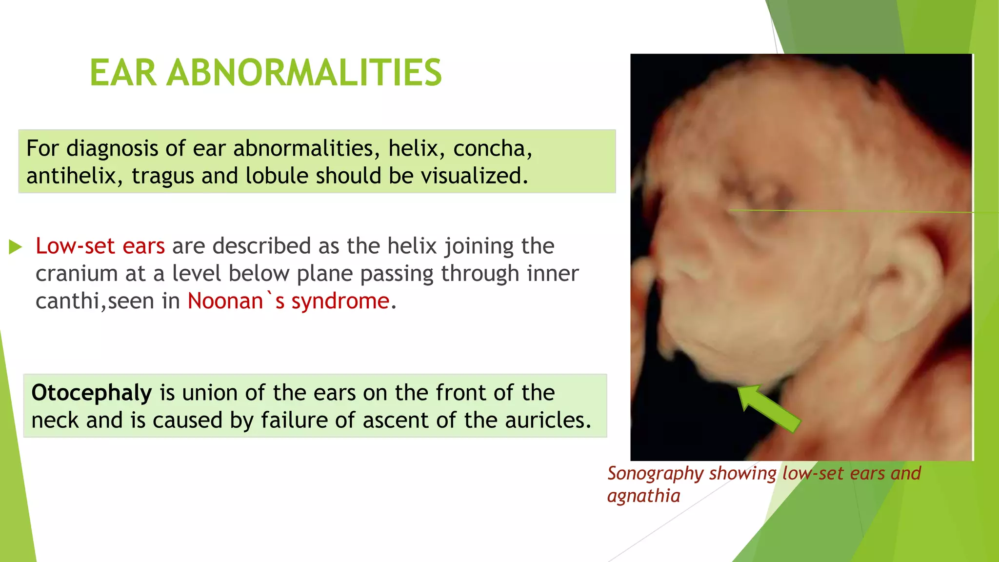 Congenital anomalies of head,neck and face(Radiology) including USG and ...