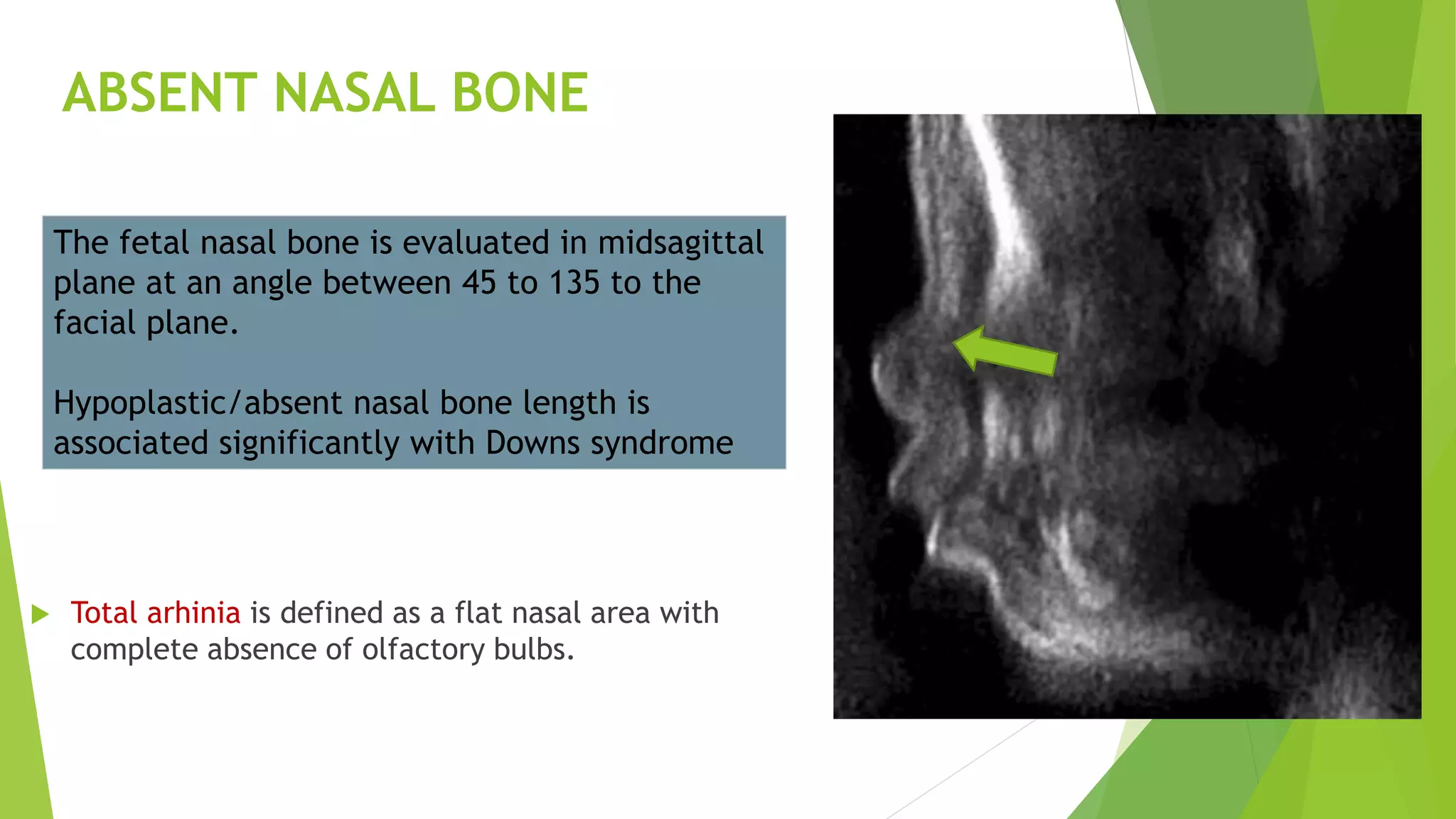Congenital anomalies of head,neck and face(Radiology) including USG and ...