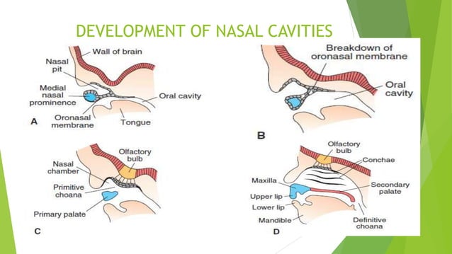 Congenital anomalies of head,neck and face(Radiology) including USG and ...