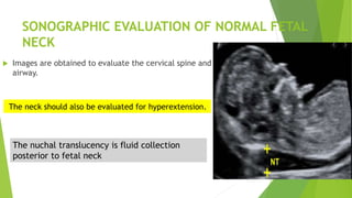 Congenital anomalies of head,neck and face(Radiology) including USG and ...