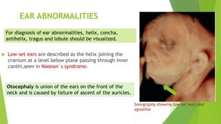 Congenital anomalies of head,neck and face(Radiology) including USG and ...