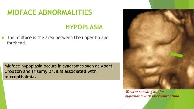 Congenital anomalies of head,neck and face(Radiology) including USG and ...