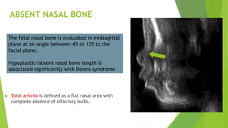 Congenital anomalies of head,neck and face(Radiology) including USG and ...