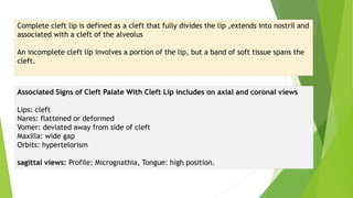 Congenital anomalies of head,neck and face(Radiology) including USG and ...