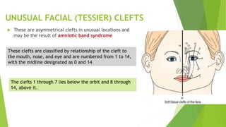 Congenital anomalies of head,neck and face(Radiology) including USG and ...