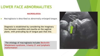 Congenital anomalies of head,neck and face(Radiology) including USG and ...