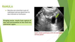 Congenital anomalies of head,neck and face(Radiology) including USG and ...