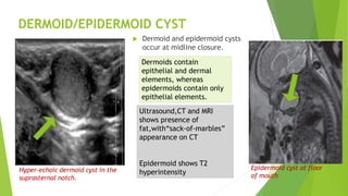 Congenital anomalies of head,neck and face(Radiology) including USG and ...