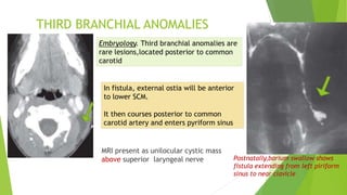 Congenital anomalies of head,neck and face(Radiology) including USG and ...