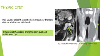 Congenital anomalies of head,neck and face(Radiology) including USG and ...