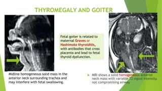 Congenital anomalies of head,neck and face(Radiology) including USG and ...