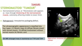 Congenital anomalies of head,neck and face(Radiology) including USG and ...