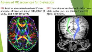 MRI evaluation of developing brain and its role in congenital brain ...
