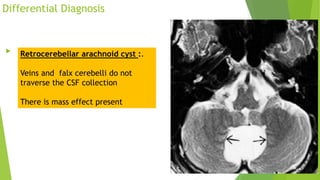 MRI evaluation of developing brain and its role in congenital brain ...