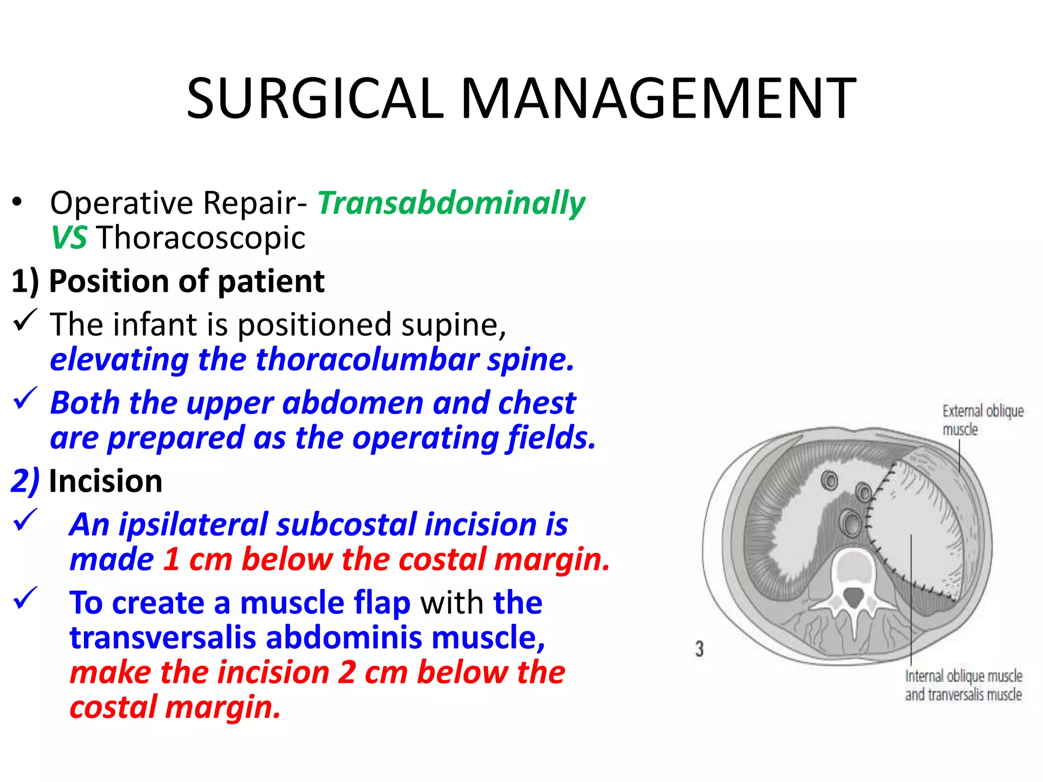 FINAL CONGENITAL DIAPHRAGMATIC HERNIA PPT.pptx