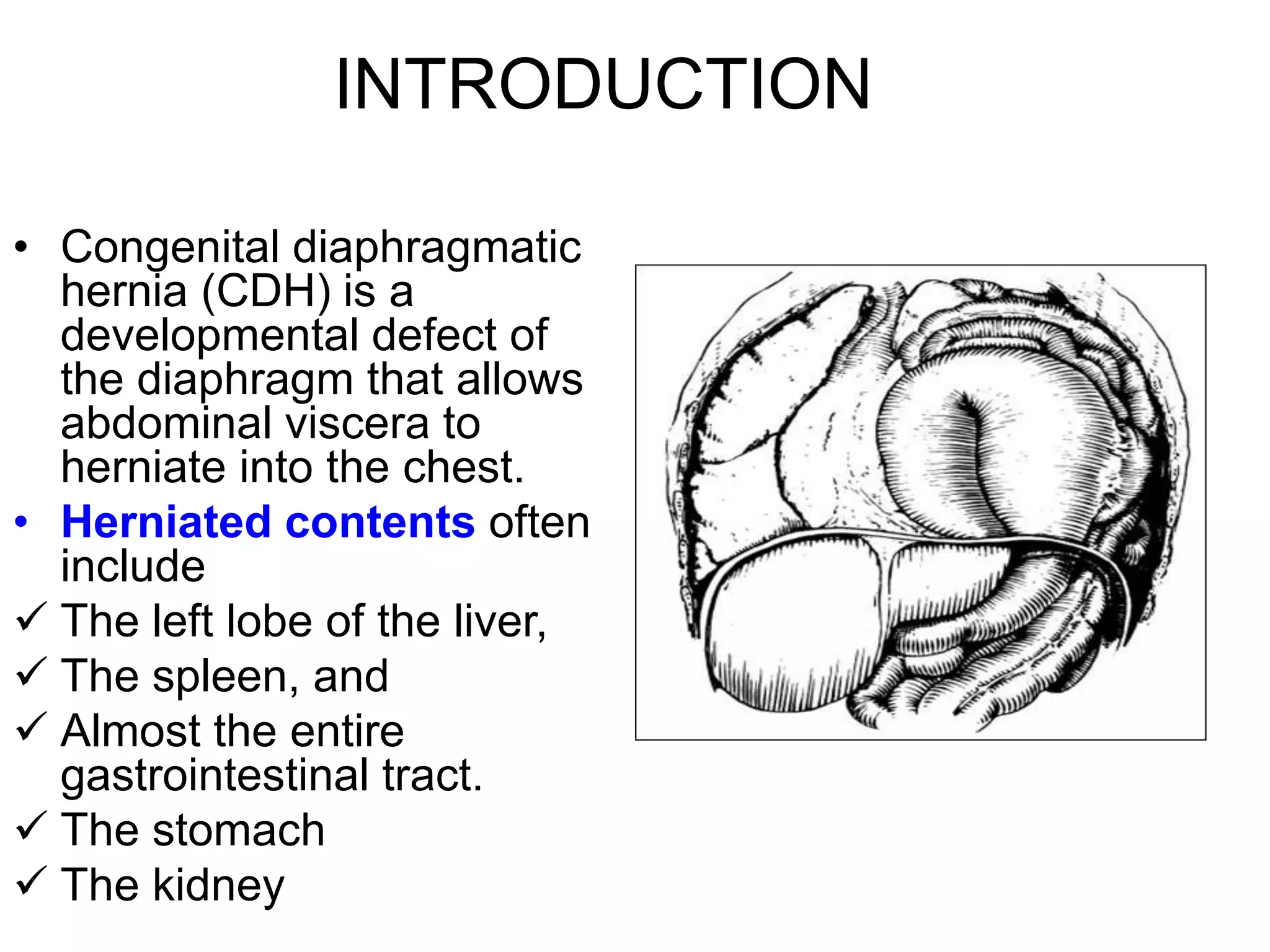 FINAL CONGENITAL DIAPHRAGMATIC HERNIA PPT.pptx