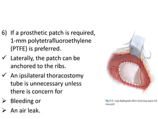 FINAL CONGENITAL DIAPHRAGMATIC HERNIA PPT.pptx