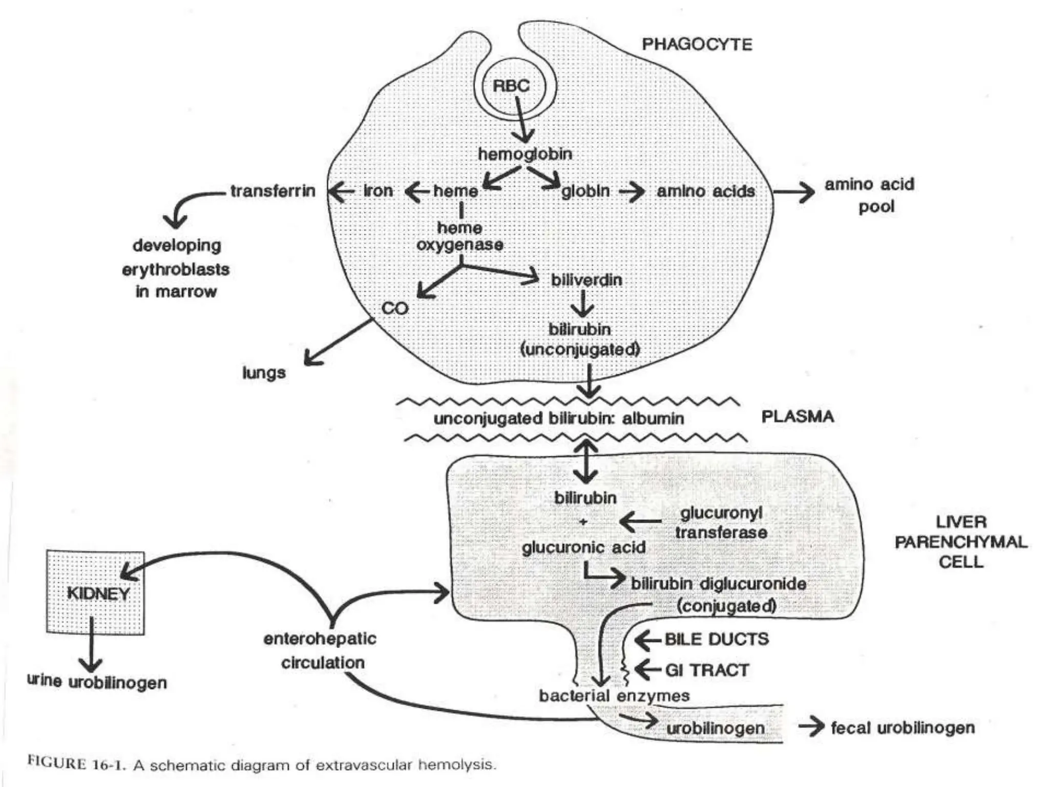 final copy of pathogenesis hemolytic anemias.ppt