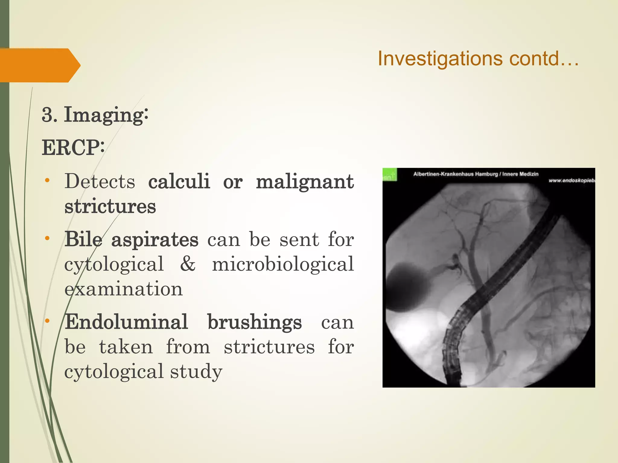 Surgical Jaundice investigations & management | PPTX