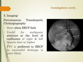 Surgical Jaundice investigations & management | PPTX | Blood Disorders ...