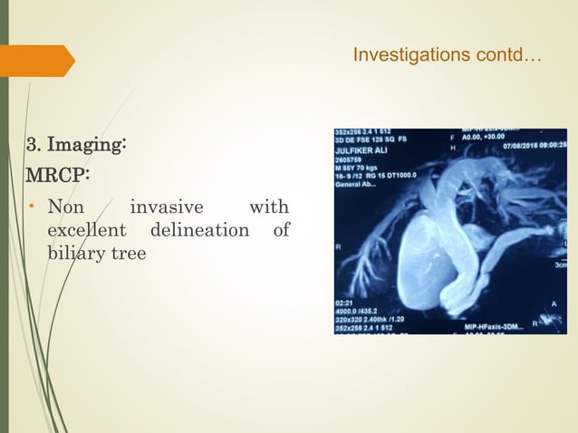 Surgical Jaundice investigations & management | PPTX | Blood Disorders ...