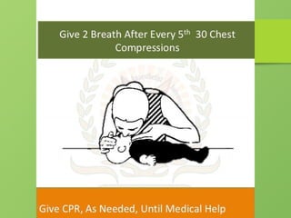 cardio pulmonary resuscitation presentation | PPTX